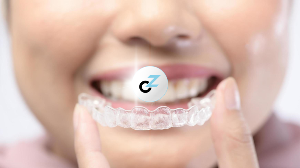 Os benefícios de utilizar aparelho transparente – OdontoZ