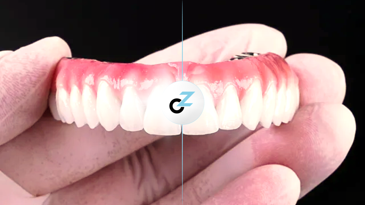 Prótese protocolo, o que é e como funciona? – OdontoZ