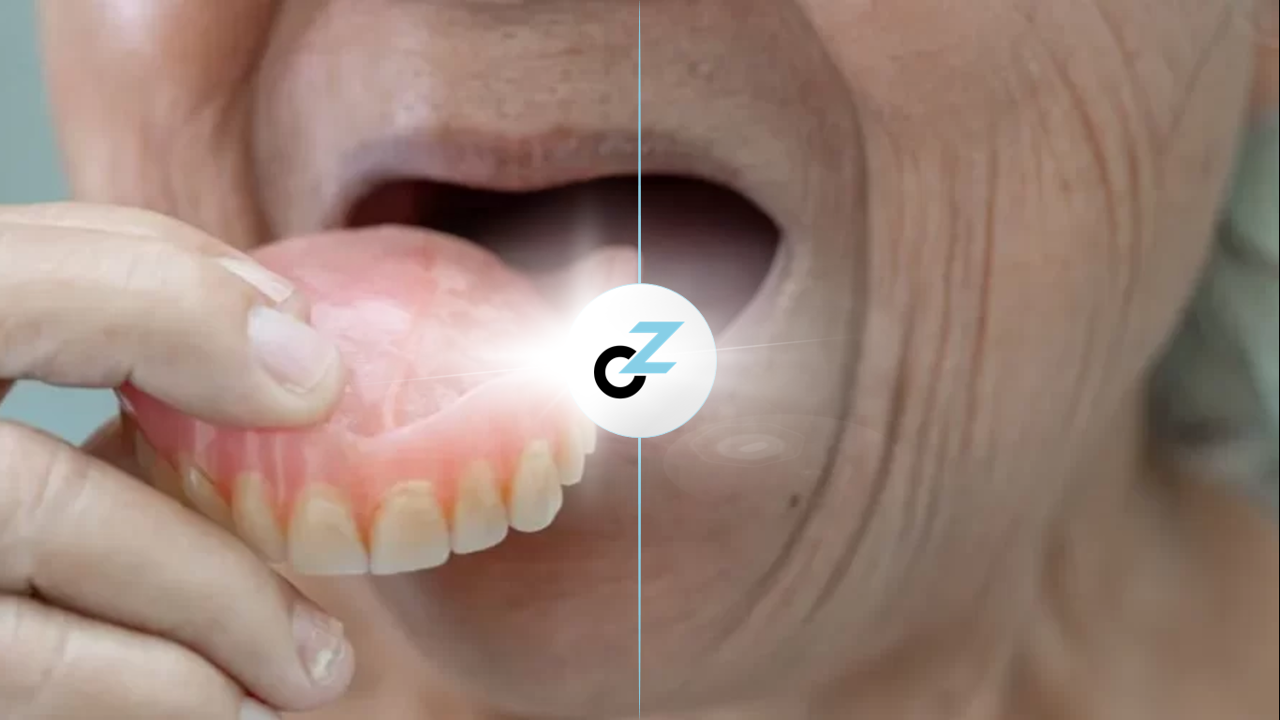 Como funciona uma prótese total? - OdontoZ